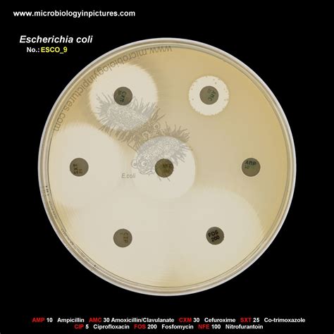 Escherichia Coli Resistant To Ampicillin And Amoxicillinclavulanate Augmentin