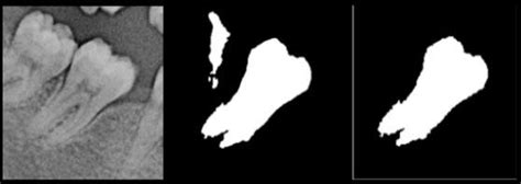 Image Segmentation Result With U Net Convolution Network A Image