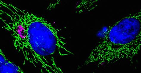 Chlamydiae Broaden Our Understanding Of The Evolution Of Intracellular Bacteria Assignment Point