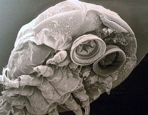 Parasite Electron Microscope