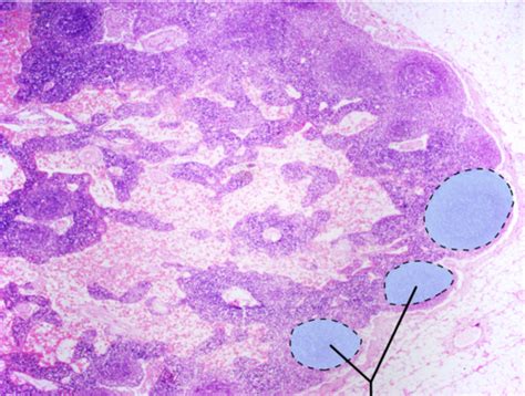Lab Practical 3 Exercise 32 And 35 Lymph Nodes Flashcards Quizlet
