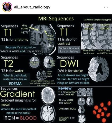 26 Radiology Ideas To Save Today Medical Knowledge Radiology