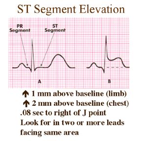 On Feeling Powerless Or Myocardial Infarction 101 « The Great Whatsit