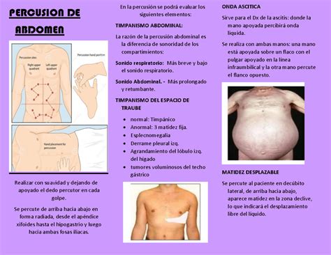 Triptico De Percusion Y Palpacion Tecnica Qx Percusion De Abdomen