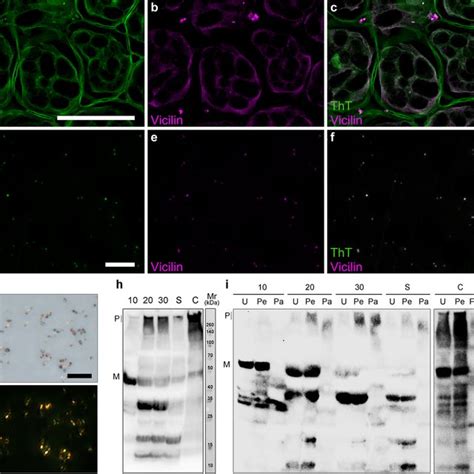 Vicilin Forms Amyloid Aggregates In Vivo A C In Situ Hybridization Download Scientific
