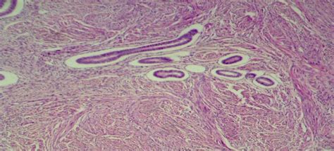 Light Microscopic Appearance Of The Uterus Showing The Endometrial Download Scientific Diagram