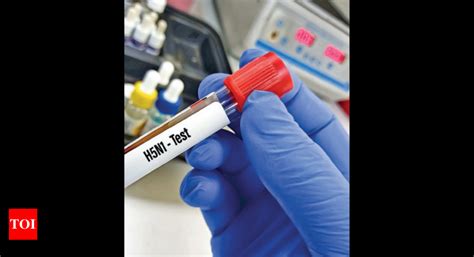 Testing Not Must For All Influenza Patients And Contacts Maharashtra Public Health Department