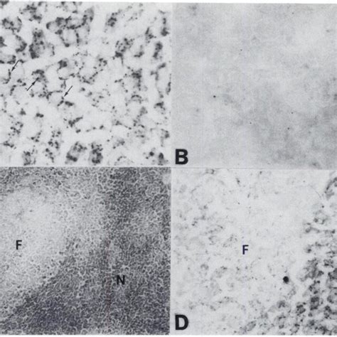 Immunocytochemical Localization Of The M 27000 Rat Liver Gap Junction