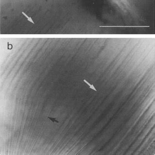 Pdf Cupula Displacement Hair Bundle Deflection And Physiological