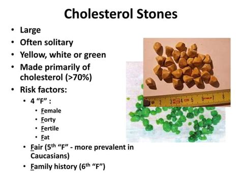 Cholecystits Classification Symptomsppt
