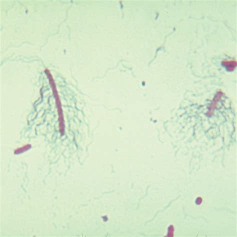 Proteus Gram Stain