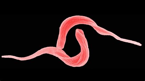 Trypanosoma Microscope Slide Trypanosoma An Overview Sciencedirect