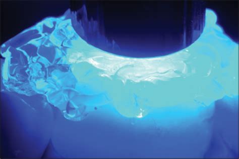 Figure 13 From Utilization Of Occlusal Index And Layering Technique In Class I Silorane Based