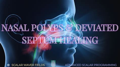 Nasal Polyps And Deviated Septum Healing Amplified Energetic In