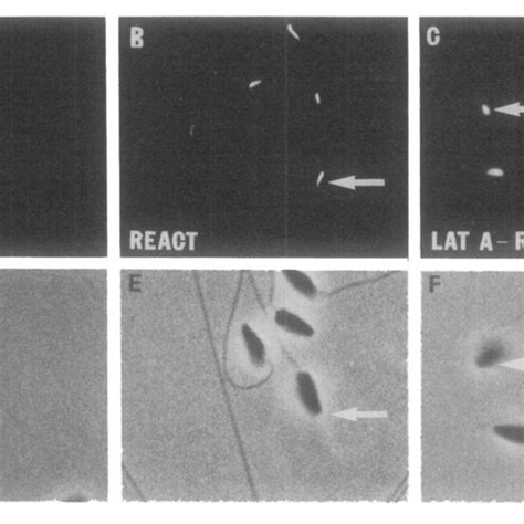 Latrunculin Inhibits Actin Polymerization During The Acrosome Reaction Download Scientific