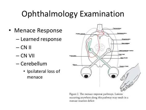 Menace Response Pathway Menace Reflex Meaning Dbluk