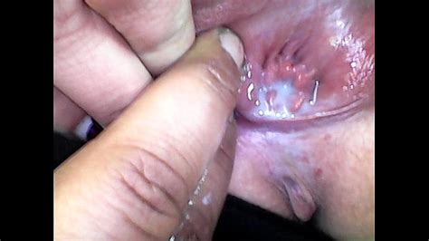 Videoand65172 Xnxx Com