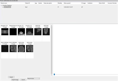 Failed To Execute Script App Issue Invesalius Invesalius GitHub