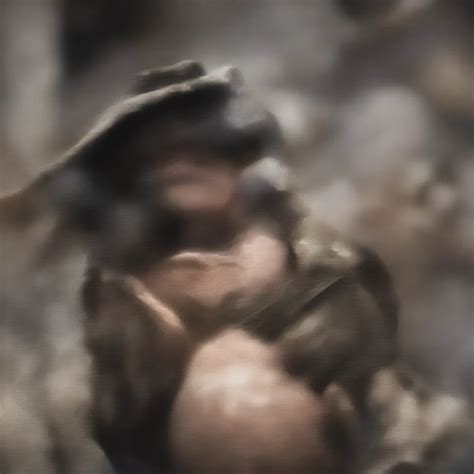 Understanding Chest Keloid Removal Keloid Formationwebp