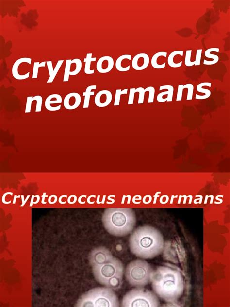 Criptococcus Neoformans Pdf Hongo Sistema Nervioso Central