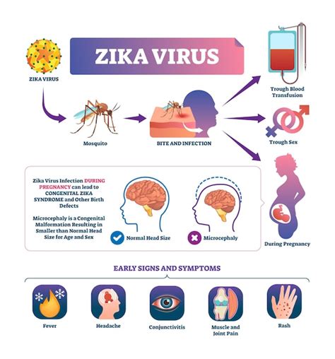 Premium Vector Zika Virus Vector Illustration Labeled Mosquito Bite