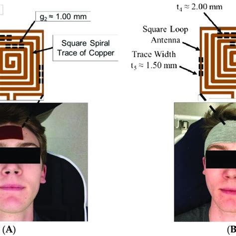 em skin patch sensor placement a adhered to forehead prior work and