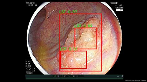 Pytorch Mask Rcnn训练自己的数据集 Pytorch Ssd训练自己的数据集mob64ca140651e5的技术博客51cto博客