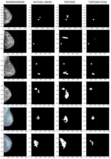 Chimp Optimization Algorithm Influenced Type 2 Intuitionistic Fuzzy C Means Clustering Based