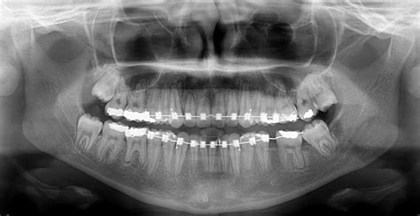 The Orthodontics Professors The Orthodontics Professors