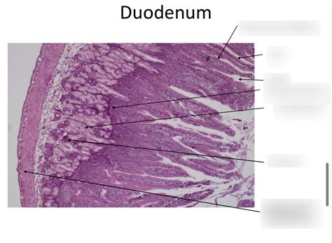 Duodenum Diagram Quizlet