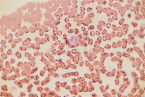 Létude Des Globules Blancs Sont Les Cellules Du Système Immunitaire