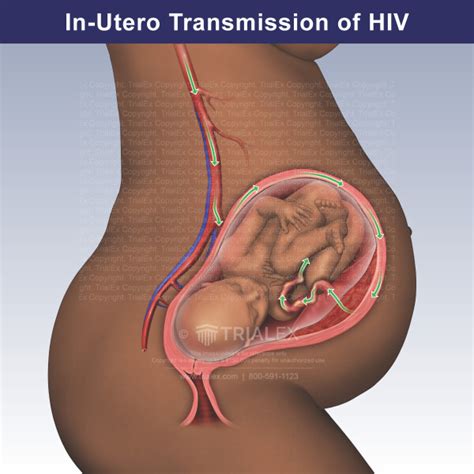 Variable Decelerations Trial Exhibits Inc