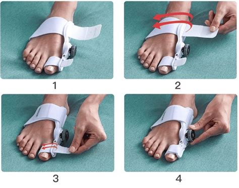 Toe Straightener Vitaflow