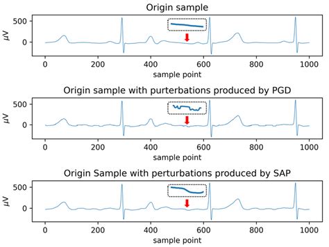 Comparison Between An Original Ecg Signal And That Attacked By Pgd And Sap Download Scientific