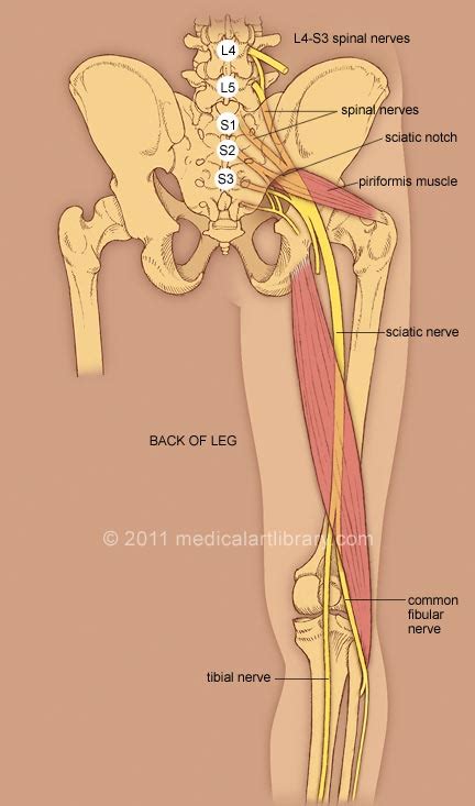 Right Sided S1 Nerve Root Compression Question R Step1