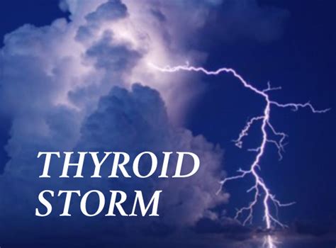 Thyroid Storm Hyperthyroidism The Lancet