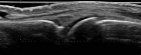 Musculoskeletal Joints And Tendons 6 4 Fingers Case 6 4 1