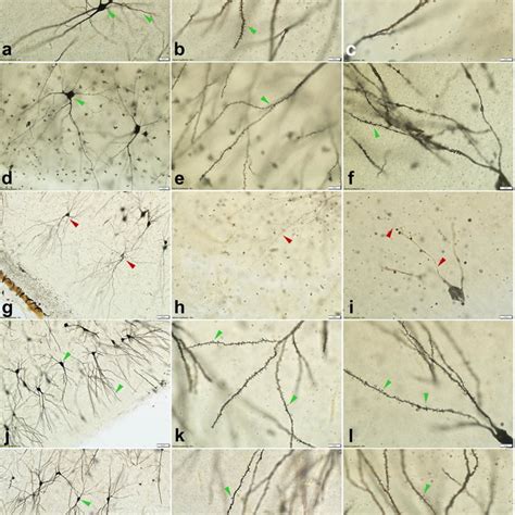 Methodological Steps In Fast Golgi Cox Staining Representation Of The