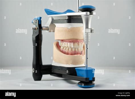 Articulator Dental Occlusion At Tasha Hyman Blog