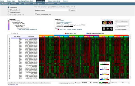 human brain atlas microarray data allen human brain atlas allen