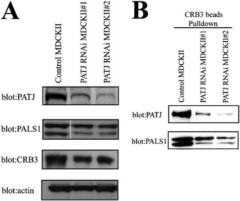 Patj Rnai Reduces Patj But Not Pals1 Or Crb3 Expression A Lysates Download Scientific