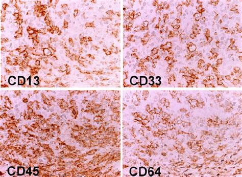Immunohistochemical Staining Of Acetone Fixed Fresh Frozen Sections