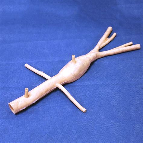 Abdominal Aortic Aneurysm Model Lifelike Biotissue