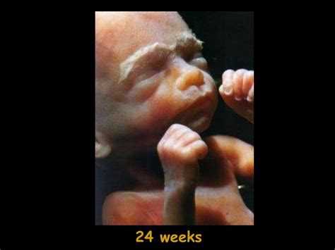 Ppt Fetal Development Powerpoint Presentation Free Download Id5502786