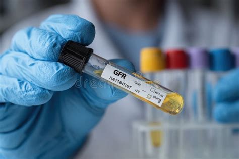 Lab Technician Presents Gfr Test Results In A Minimal Layout Showing A