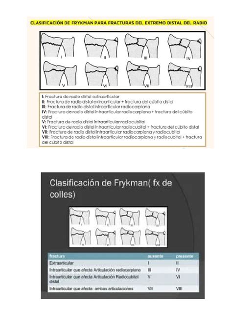 Clasificacion Frykman Pdf