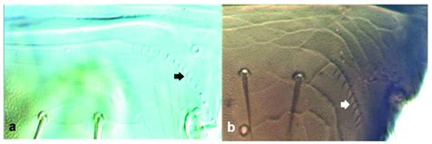 Position Of Ctenidia On Abdominal Segment Viii A Antero Laterally To