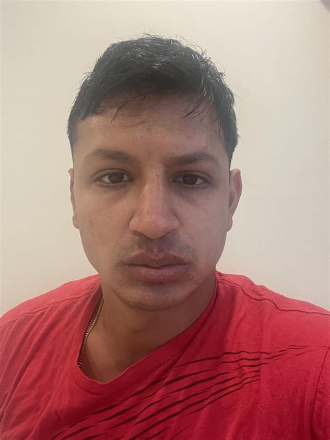 Do I Look Like I Have An Overbite Does It Make Me Look Really Ugly