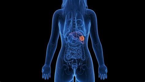 Oxalosis Bilder Durchsuchen 359 Archivfotos Vektorgrafiken Und