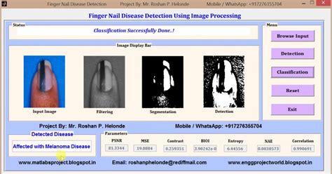 Finger Nail Disease Detection Using Machine Learning Full Project Source Code ~ Engineering Projects